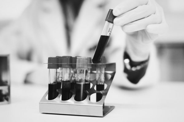 Grafeno: usos y aplicaciones de un material pionero - Solmeglas SL